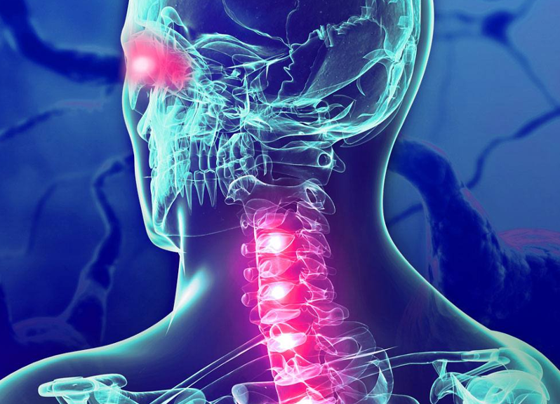 Por el Día de Neuromielitis Óptica realizarán encuentro entre médicos y ...